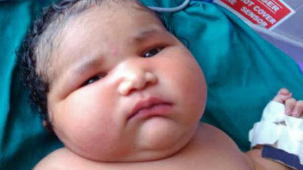 Woman gives birth to world’s heaviest ever baby girl - Malayalam Oneindia