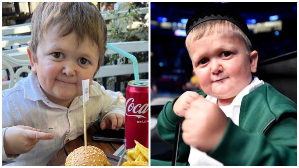 Hasbulla magomedov who look like a kid challenges mma fighters goes ...