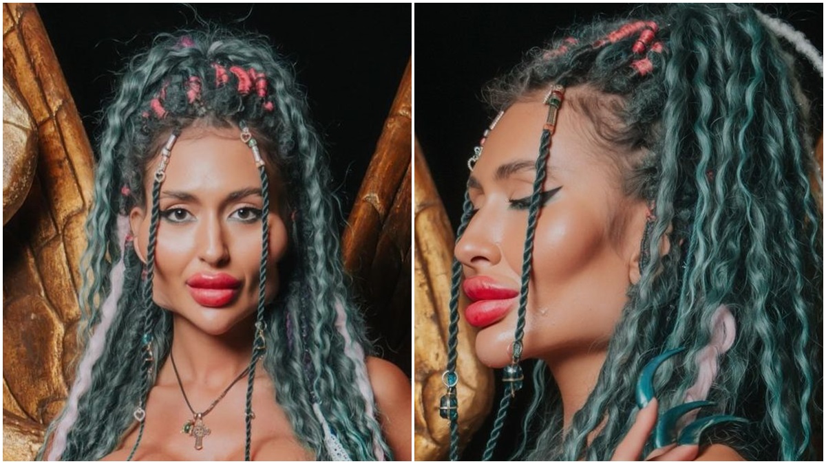 Anastasia Pokreshchuk, Who Has The Biggest Cheeks In The World ...