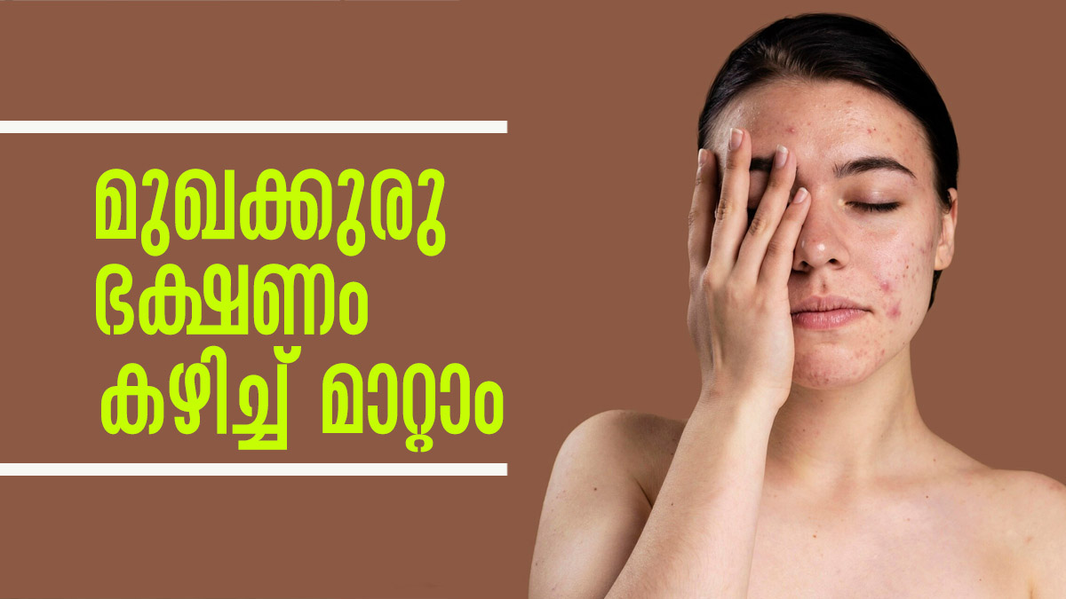 മത്തനും മധുരക്കിഴങ്ങും.. തീര്‍ന്നില്ല; മുഖക്കുരു എന്നന്നേക്കുമായി ...